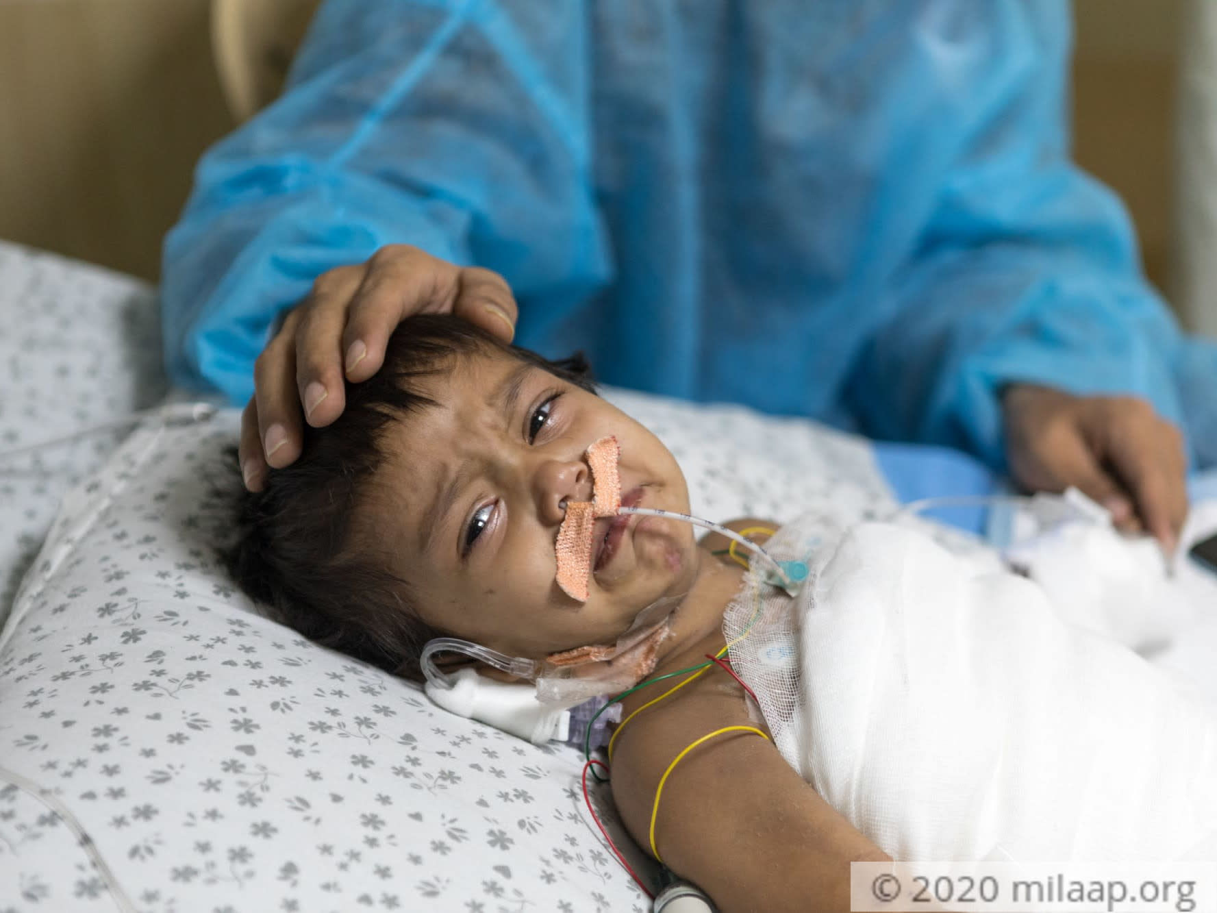 With Their Severely Burnt Baby In Their Arms, They Ran From One ...