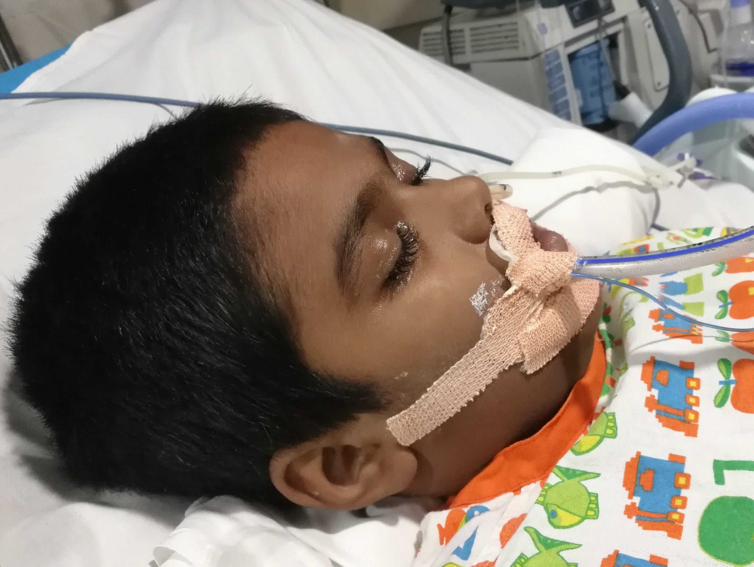 In Just 3 Days, A Rare Disorder Left This 10 Year Old's Entire Body ...