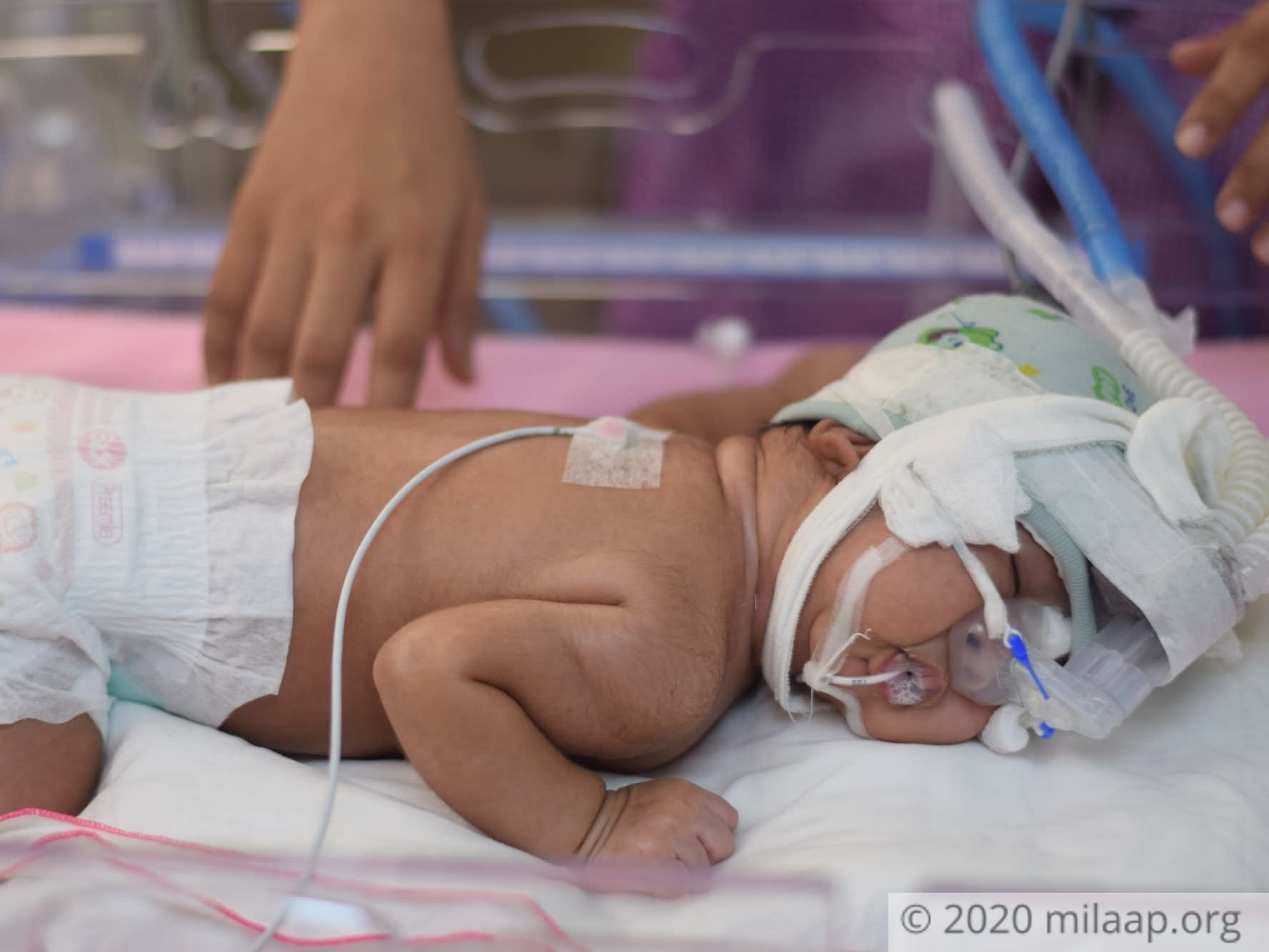 Your contribution can save this newborn and give him a second chance at ...